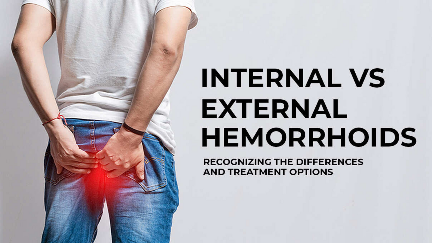 Internal vs External Hemorrhoids and Treatment Options
